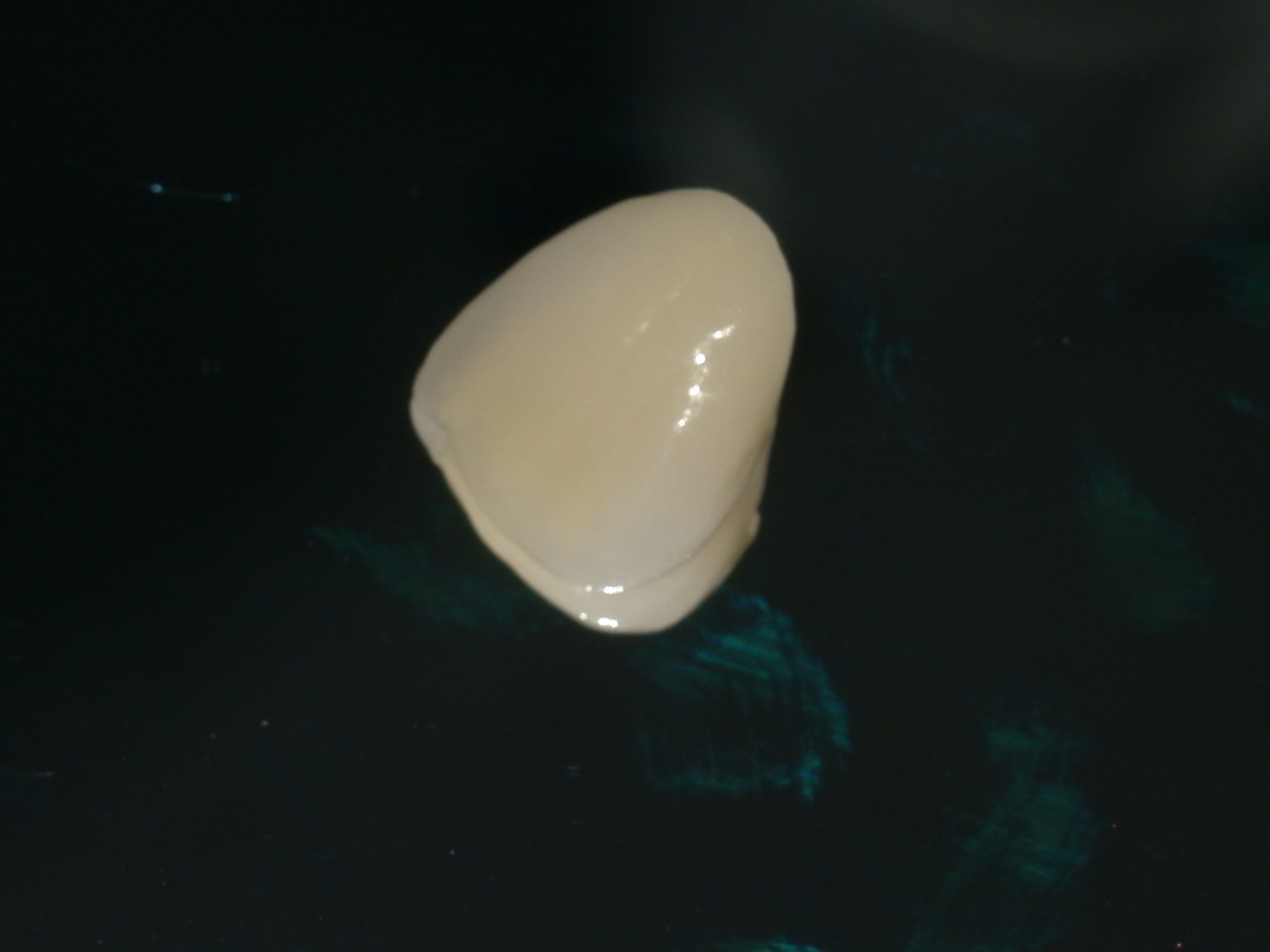 SHOFU DENTAL DIGITAL CAMERA | ひだまり歯科